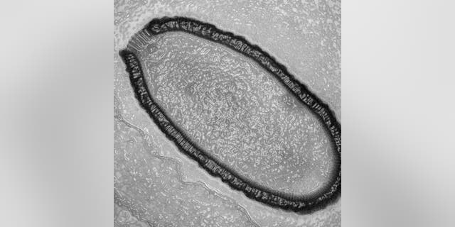 Giant virus resurrected from permafrost after 30,000 years | Fox News