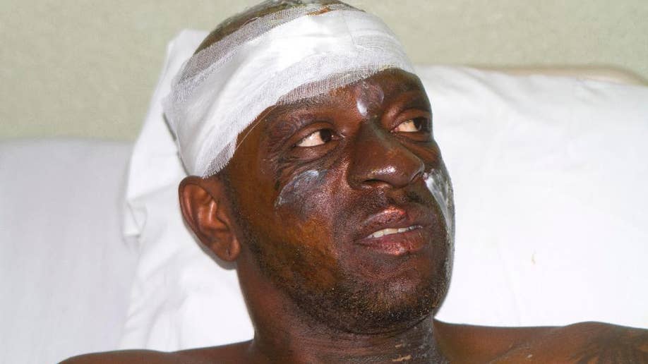 Singer burned in deadly Haiti Carnival accident explains how it may ...