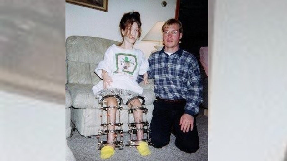Woman Opens Up About Rare Form Of Dwarfism Bone Lengthening Surgeries