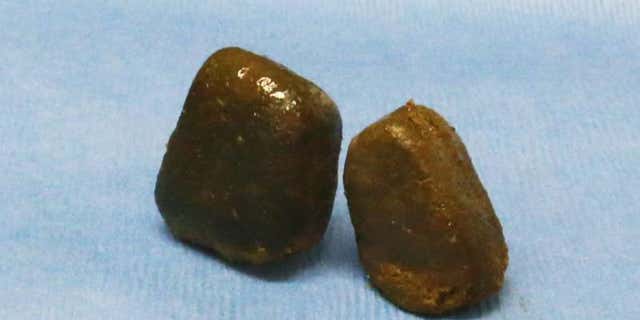 Scientists finally know how wombat butts make cube-shaped poops | Fox News