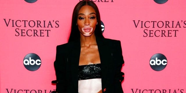 Winnie Harlow defends ‘America’s Next Top Model’ comments | Fox News