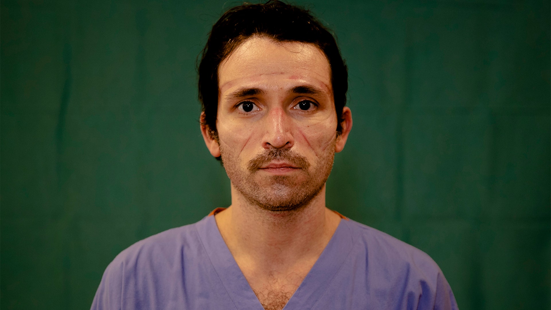 Photos: Italy's coronavirus medical heroes | Fox News