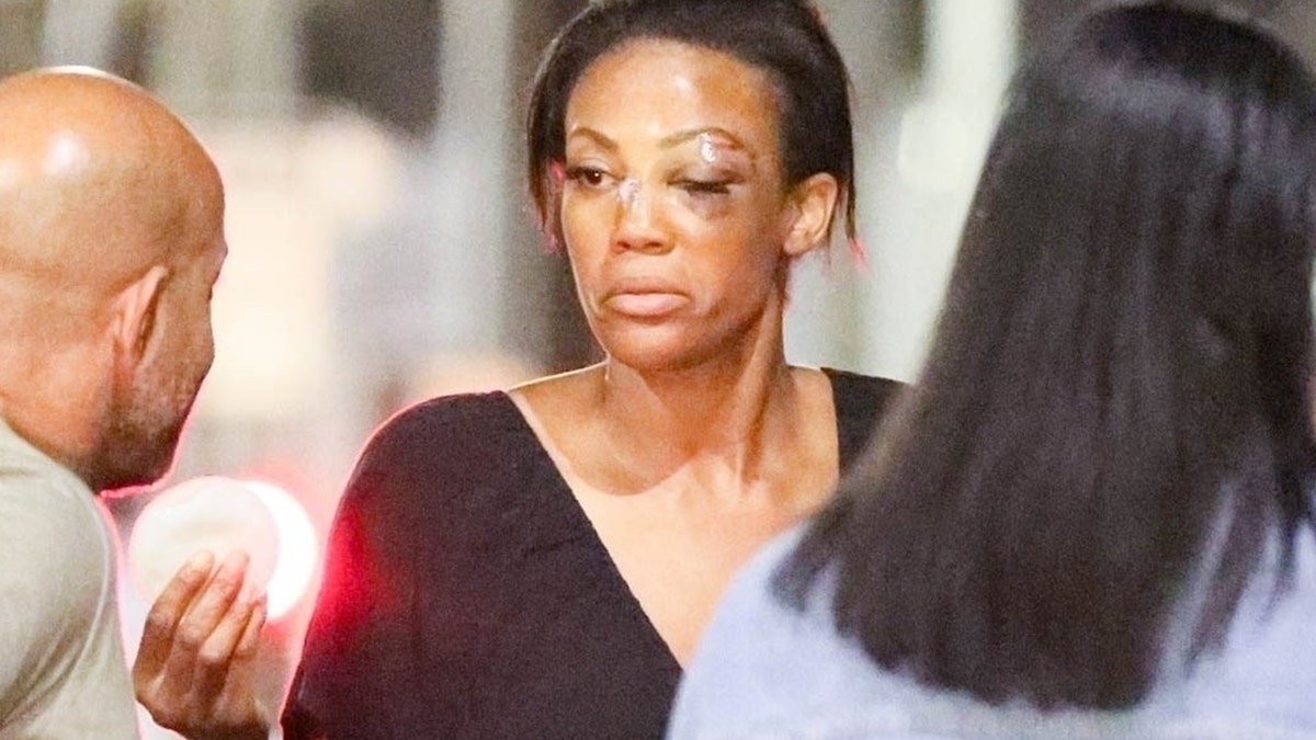Olympian Kim Glass Pleads For La Crime Crackdown After Attack By Homeless Man What Does It