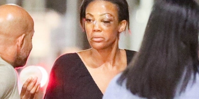 Olympian Kim Glass pleads for LA crime crackdown after attack by ... Olympian Kim Glass pleads for LA crime crackdown after attack by ...