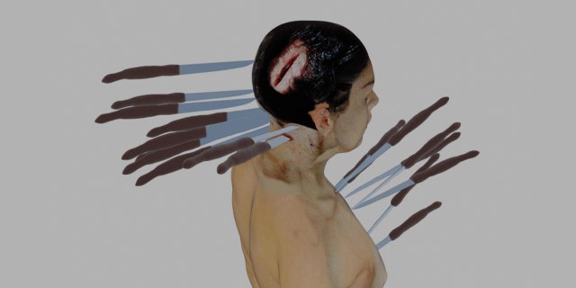Philadelphia Suicide Designation For Woman With 20 Stab Wounds Bruises Philadelphia Suicide Designation For Woman With 20 Stab Wounds Bruises