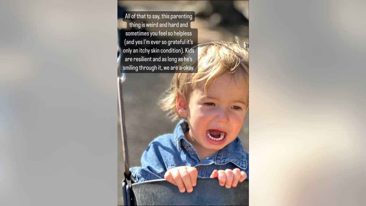 Mandy Moore Reveals That Her Son Gus 2 Has Gianotti Crosti Syndrome Sometimes You Feel So