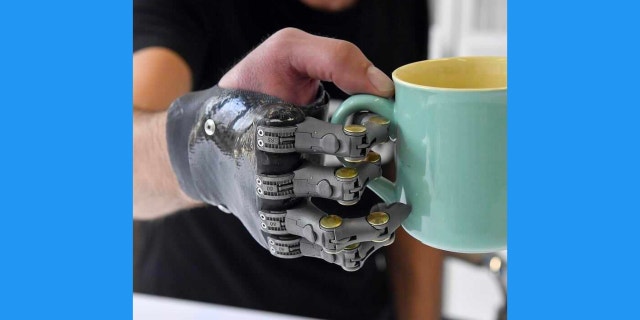 Breakthrough prosthetic fingers revolutionize the lives of amputees ...