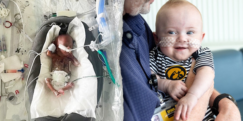 Schattige Premature Baby Happy World Prematurity Day 💜 A Premature